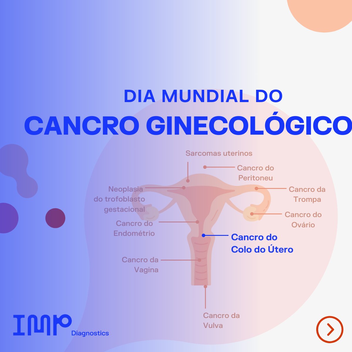O Que é o Cancro Ginecológico? - IMP Diagnostics